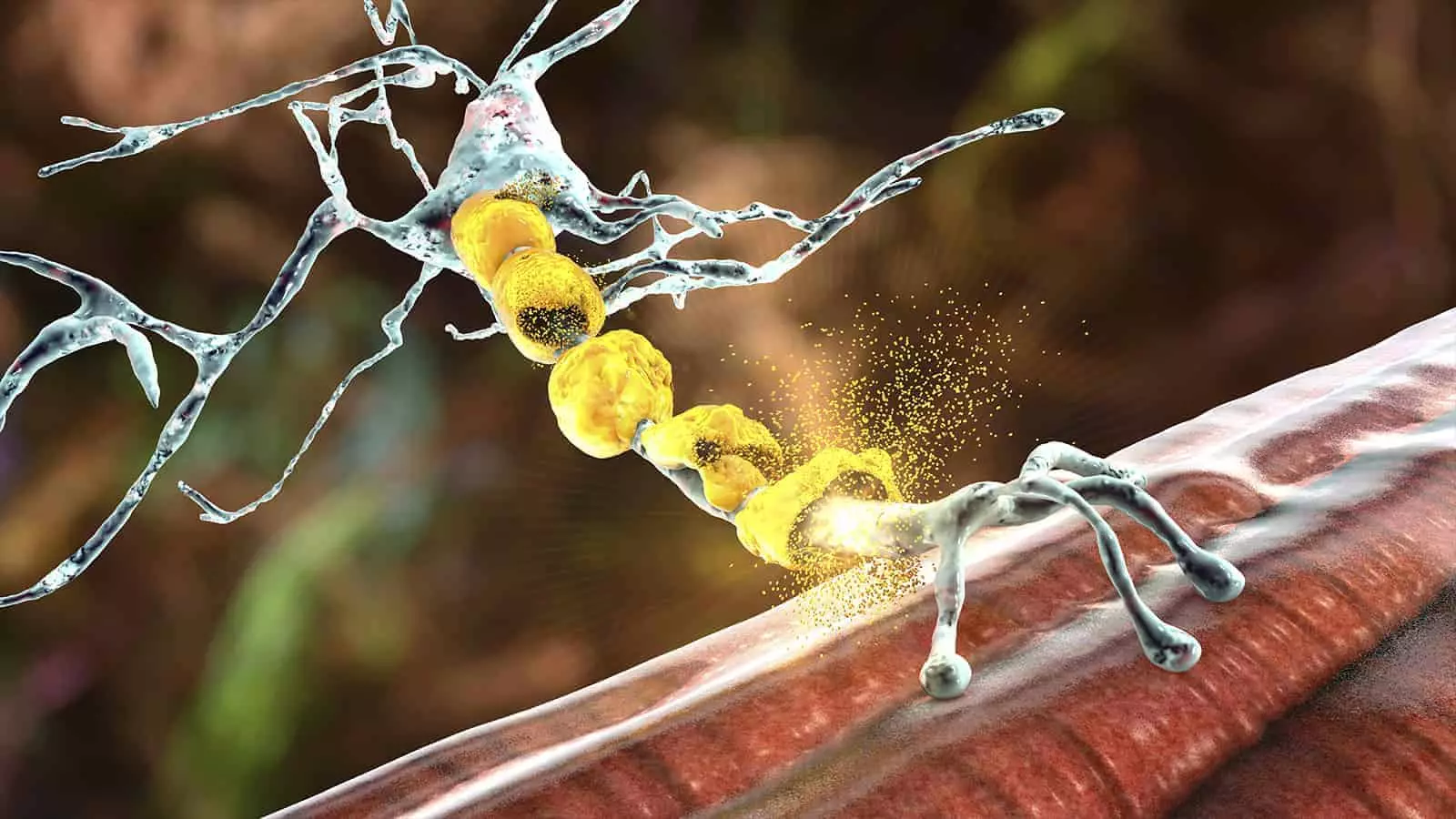 Neurologové vysvětlují příčiny a příznaky neuropatie malých vláken