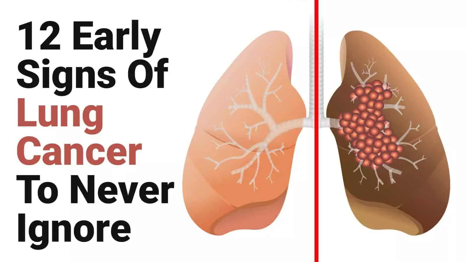 12 raných příznaků rakoviny plic, které nikdy neignorujte