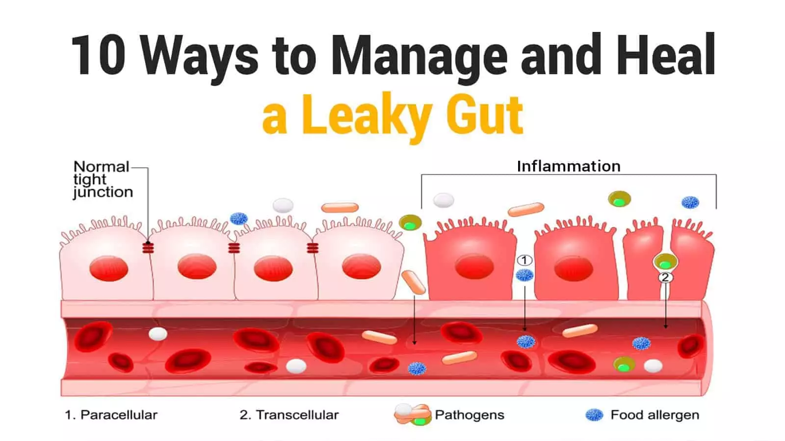 leaky gut