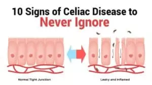 mgbaàmà celiac