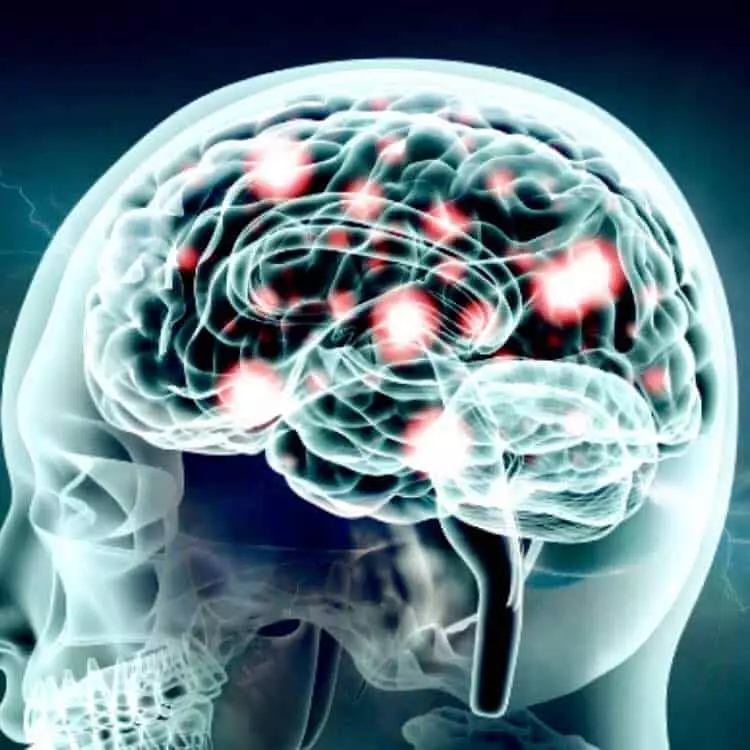 MIT-Forscher enthüllen Entdeckung, die das Gehirn weiterentwickeln könnte