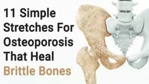 ປ້ອງກັນ osteopenia ແລະ osteoporosis