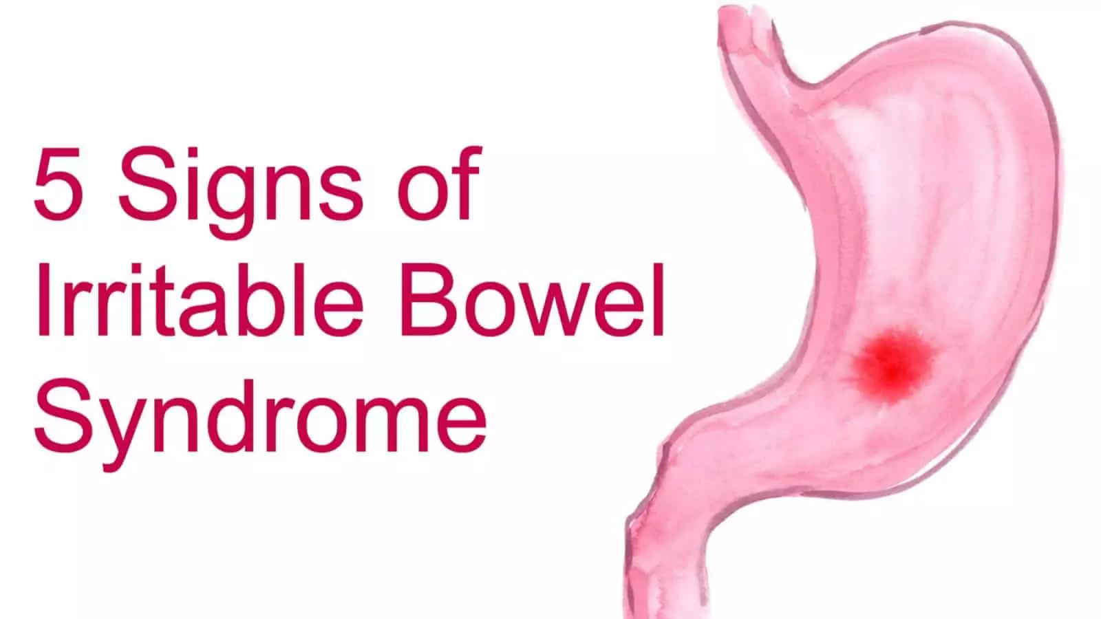 irritable bowel syndrome